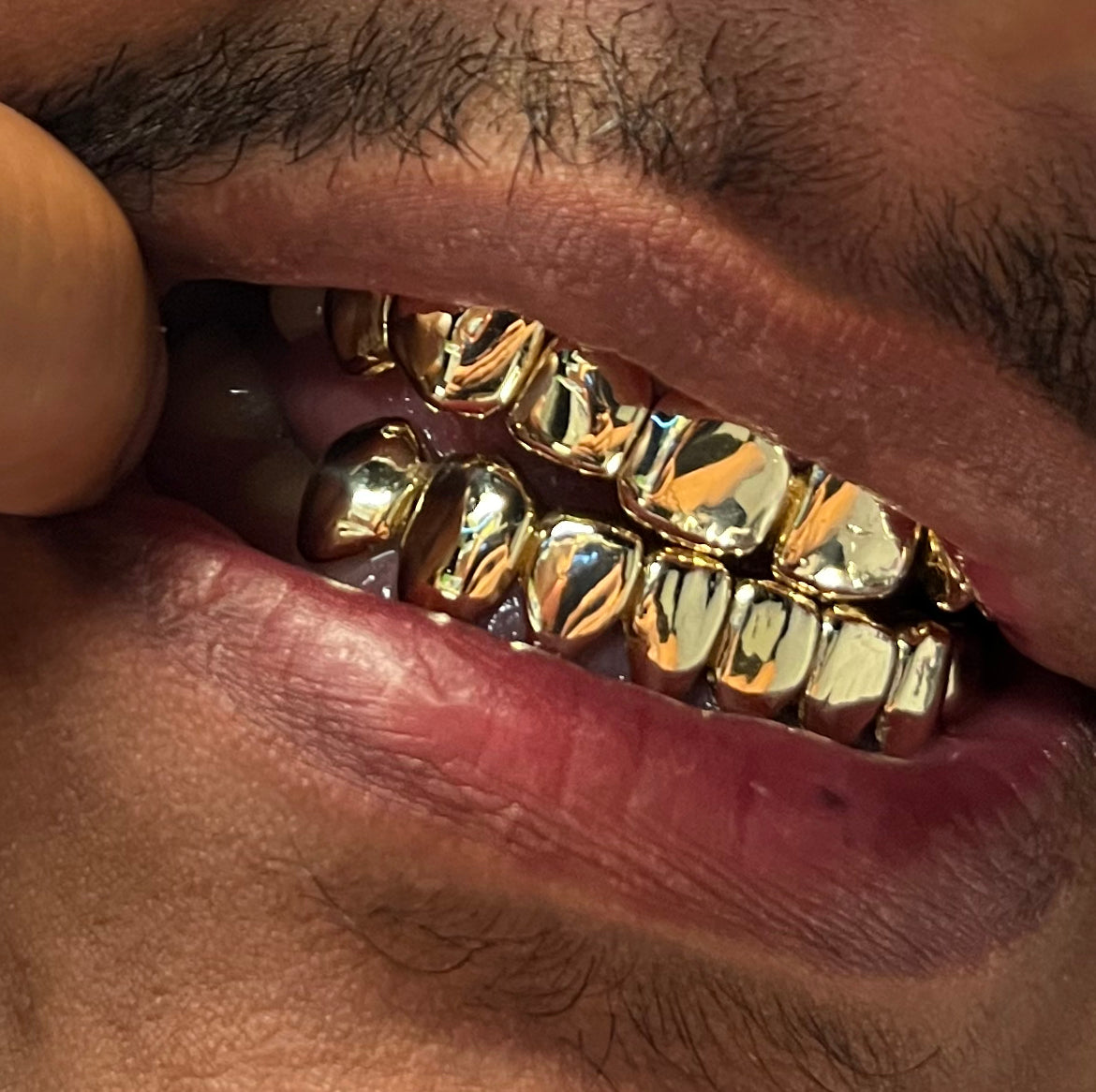 Gold Grillz – Lugo The Jeweler